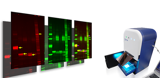 Global Gel Documentation Systems Market Revenue Strategy 2020 - Bio-Rad ...