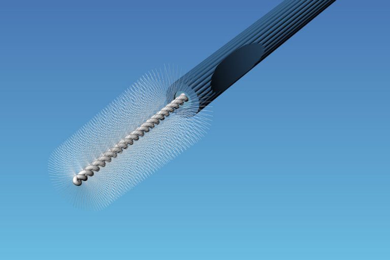 Global Cytology Brush Market Comprehensive Study, Rising Growth ...